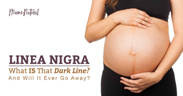 Linea Nigra: ¿Qué ES Esa Línea Oscura? ¿Y alguna vez desaparecerá ...